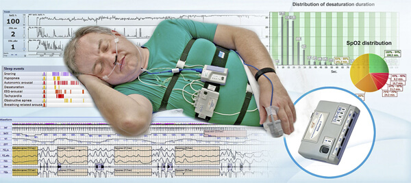 polissonografia como funciona