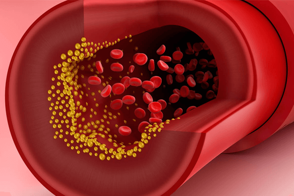 níveis de triglicerídeos